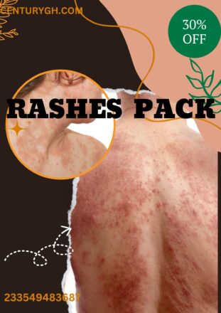 Skin Rashes Organic Solution - CENTURY GH